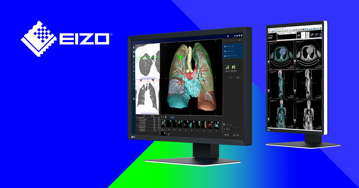 Referencias | Monitores médicos de EIZO