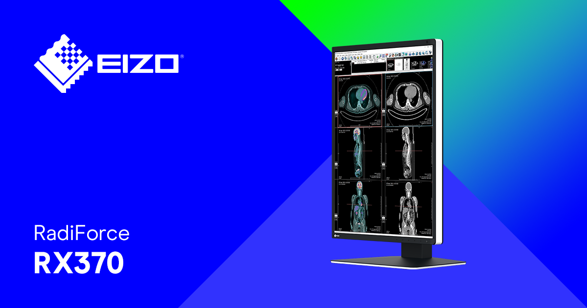 RadiForce RX370 | Monitor de diagnóstico (color y escala de grises)